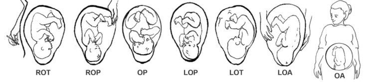 The Nurse’s Role in Reducing Cesarean Births – THE TAPROOT DOULA PROJECT